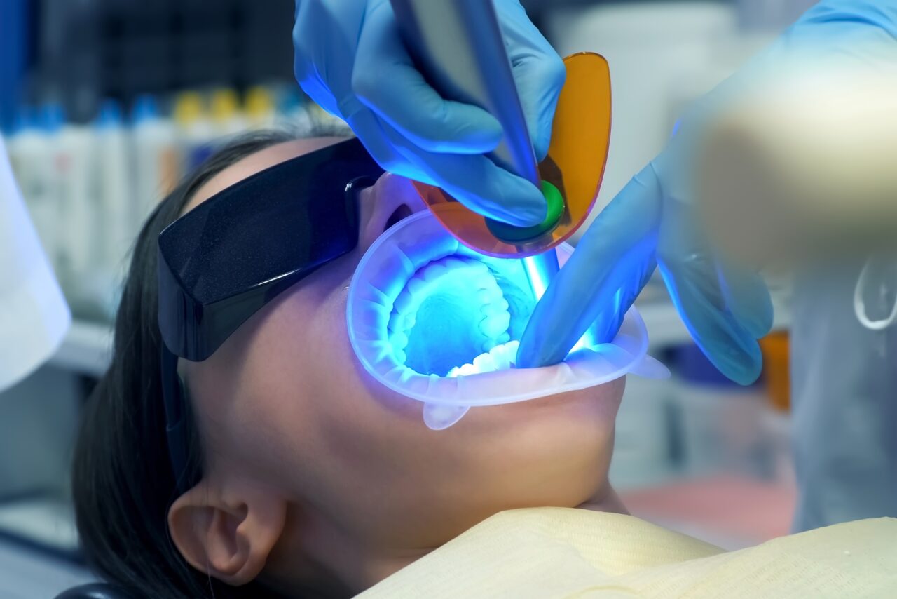 What Is UV Curing, And How Does It Work? - Intellego Technologies